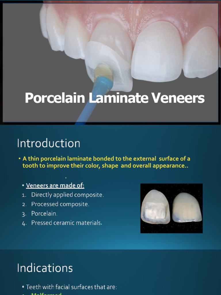 Labial Veneers - Summary | Download Free PDF | Dentistry Branches