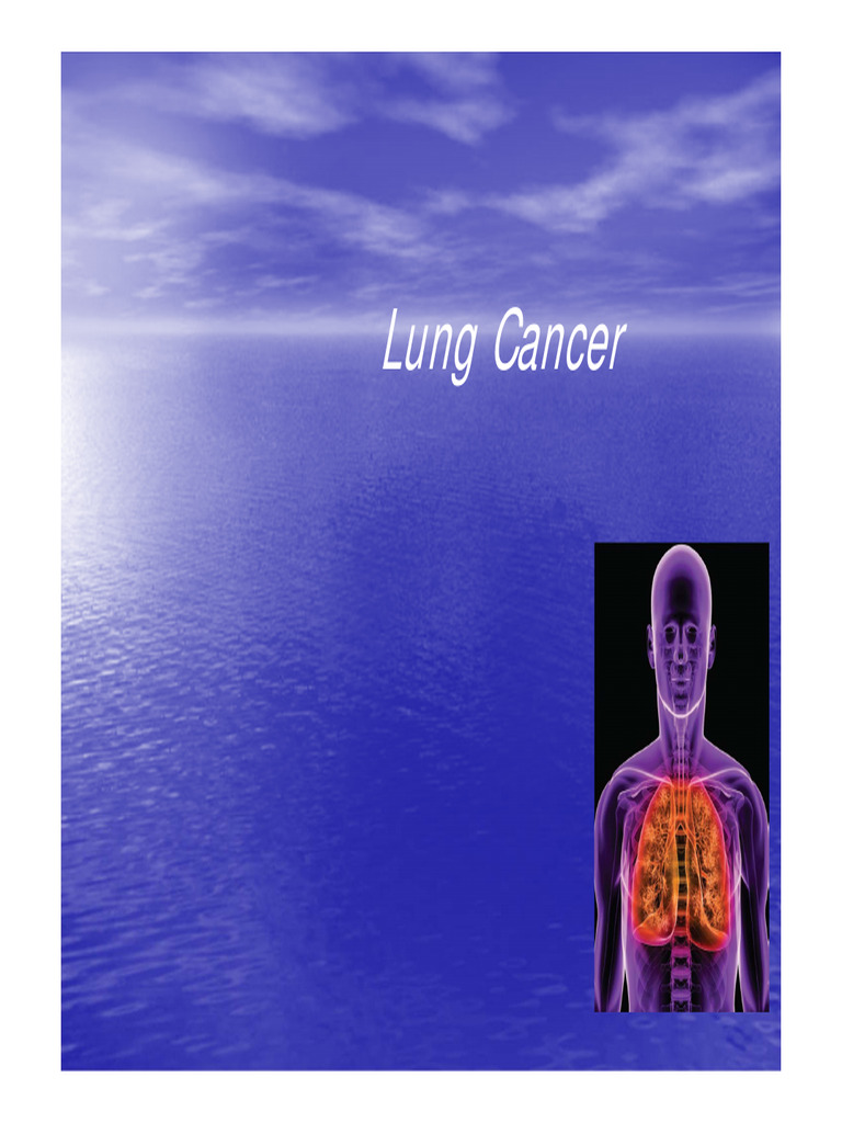 Lung Cancer Presentation Final | PDF | Lung Cancer | Cancer