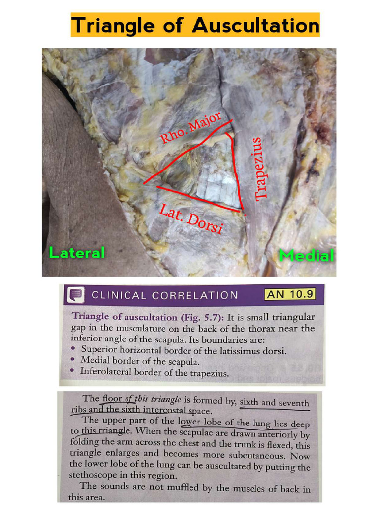 Triangle of Auscultation | PDF