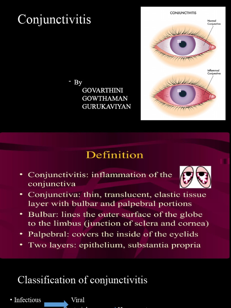 Conjunctivitis | PDF