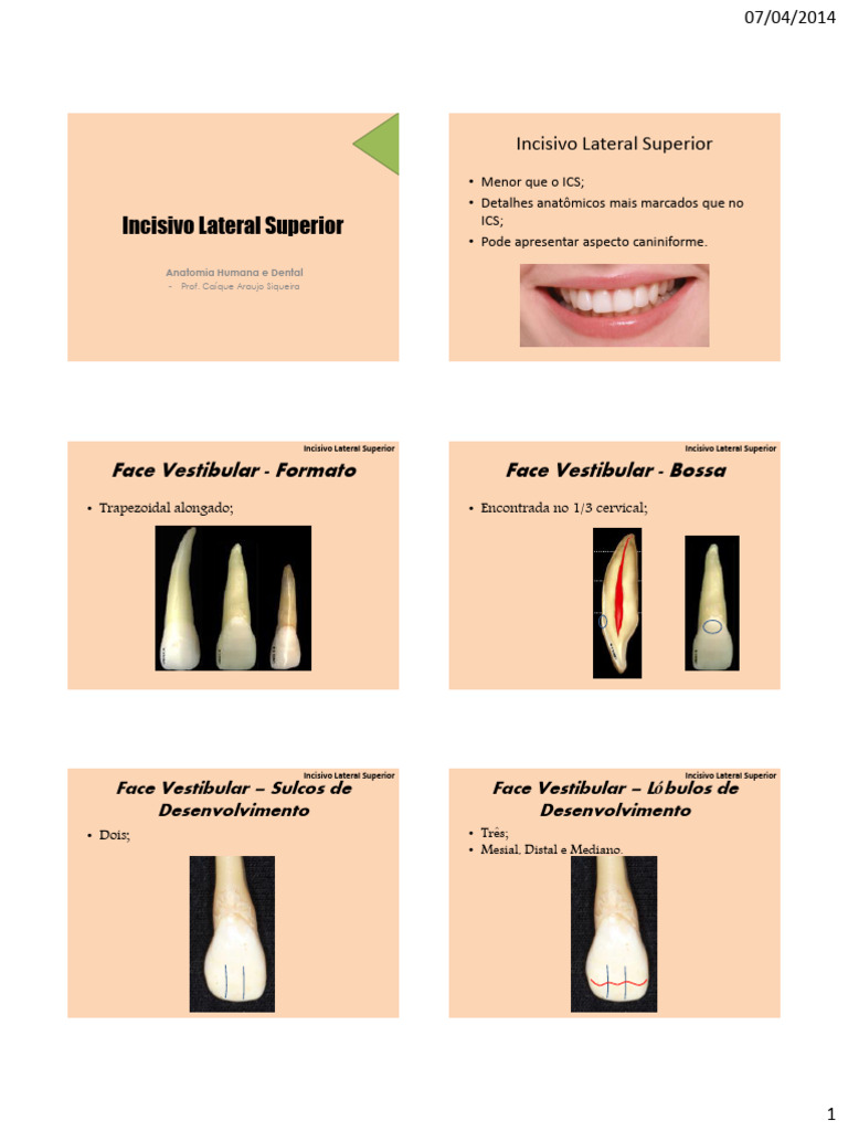 Anatomia do Incisivo Lateral Superior | PDF | Dente | Anatomia dental