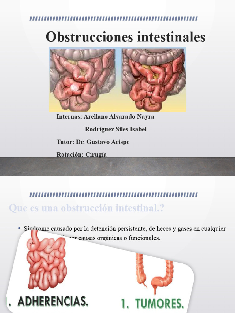 Obstrucciones intestinales 2 | PDF | Tracto gastrointestinal ...