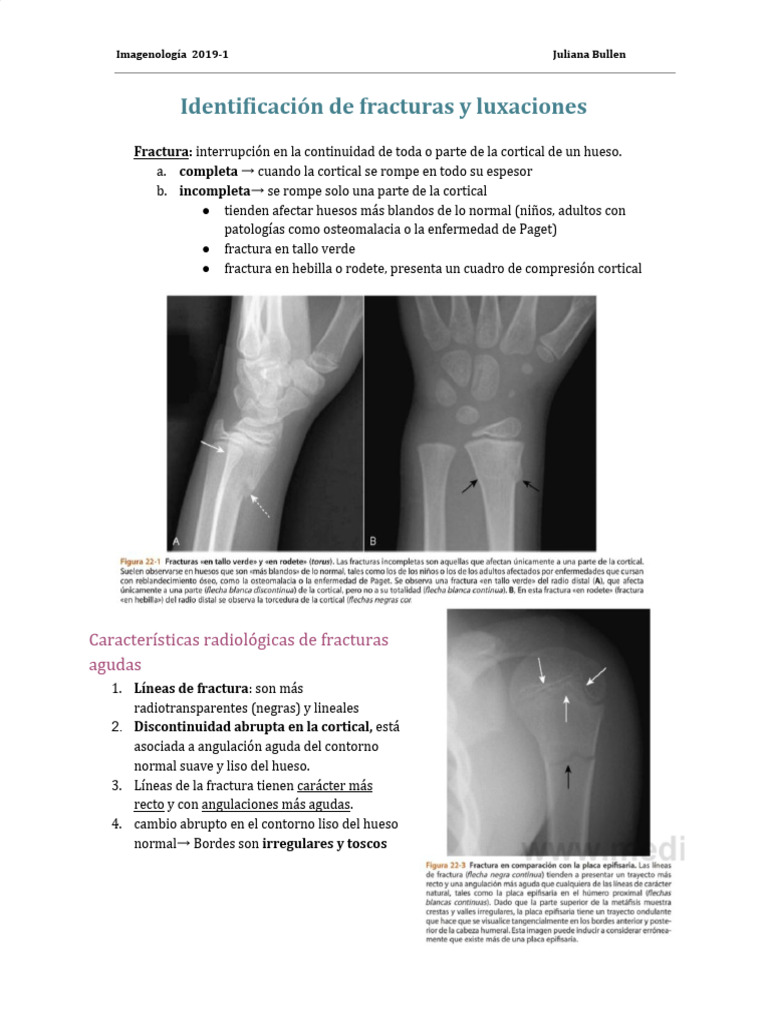 12. Identificación de fracturas y luxaciones | PDF | Hueso | Hombro