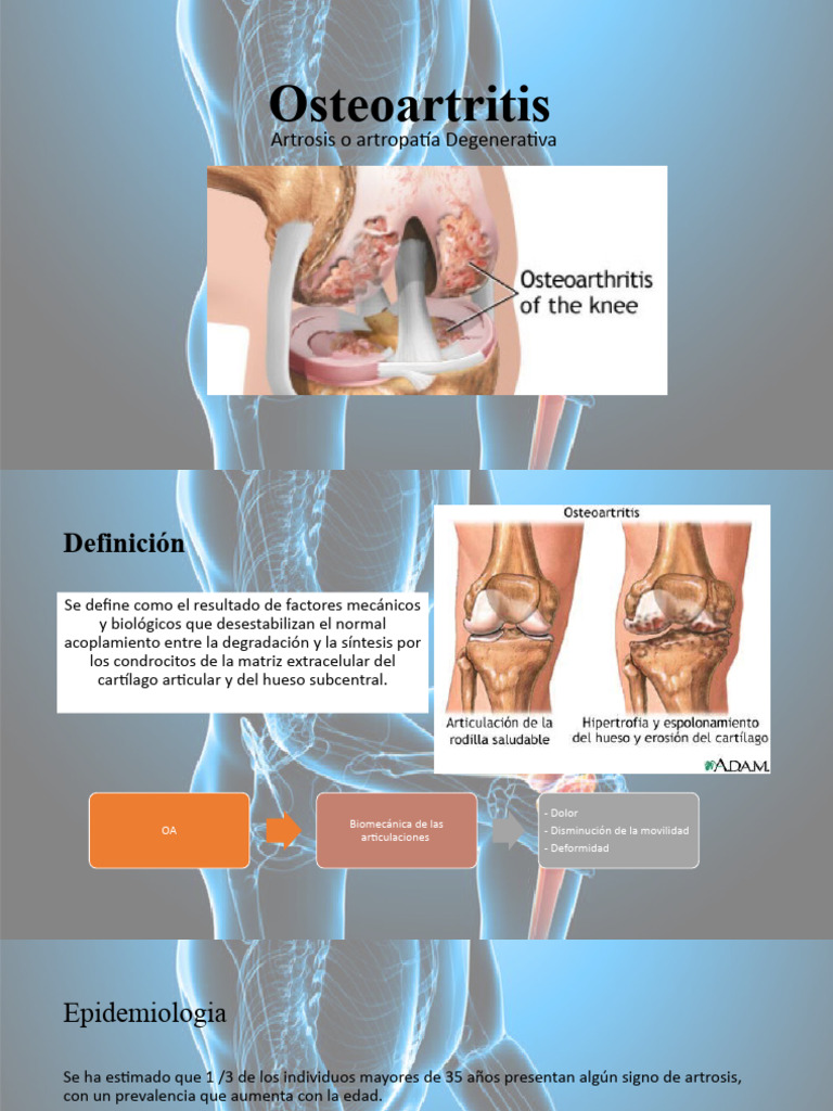 Osteoartrosis | PDF | Osteoartritis | Articulación