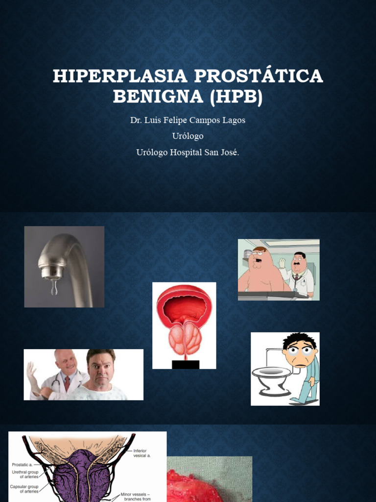 Hiperplasia Prostática Benigna (HPB) 2 | PDF | Cancer de prostata | Antígeno específico de la ...