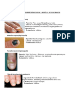 Onicectomia | PDF | Clavo (anatomía) | Dedo del pie