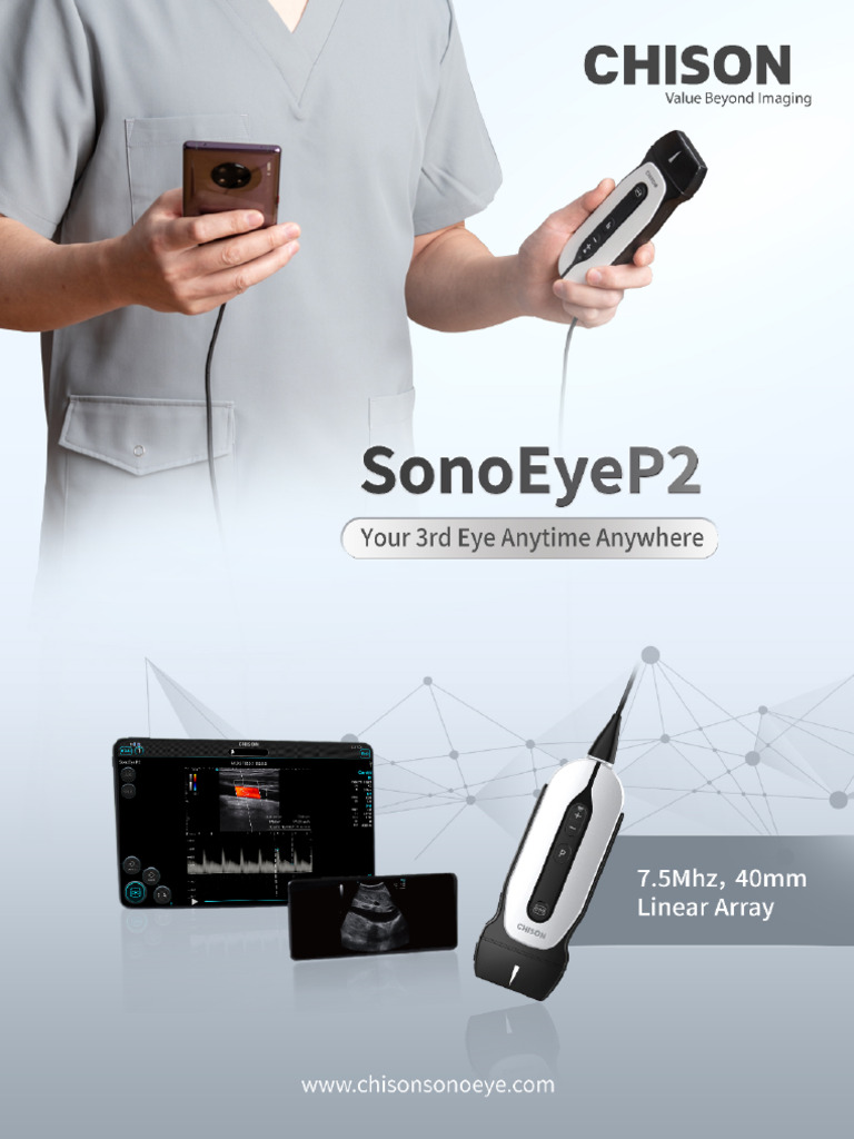CHISON - SonoEye | PDF