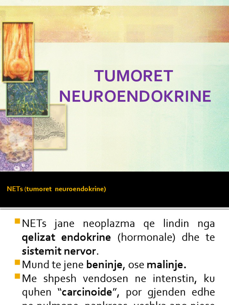 Kirurgji Speciale, Neoplazite Neuroendokrine | PDF