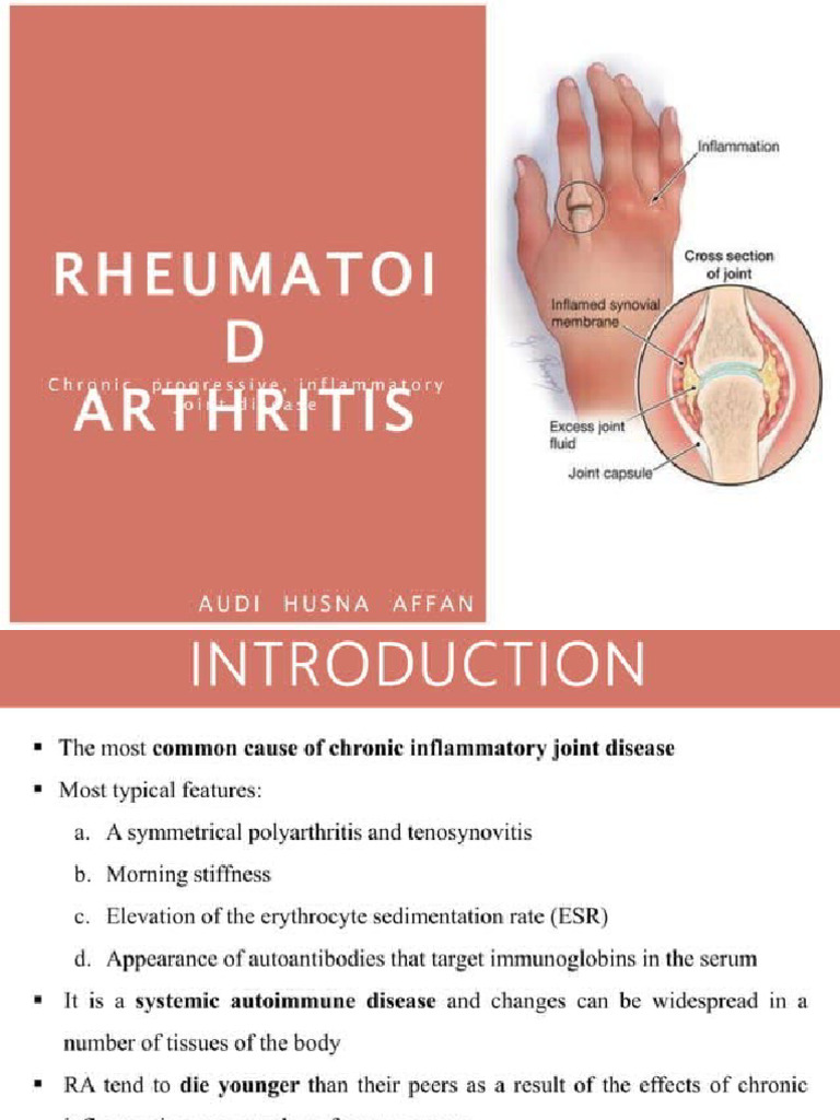4- Rheumatoid Arthritis | PDF