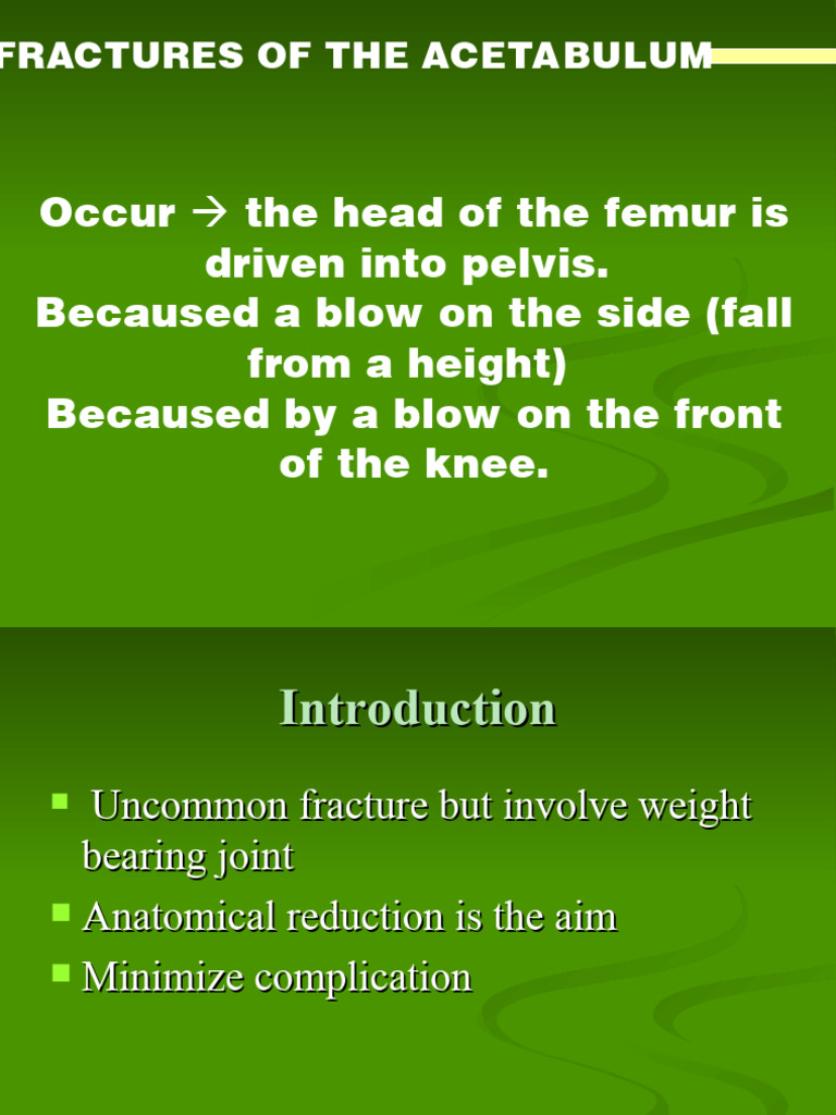 Acetabulum Fractures Overview | PDF | Hip | Pelvis