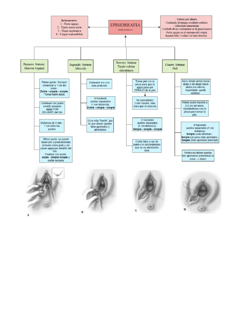 Episiorrafia PDF | PDF