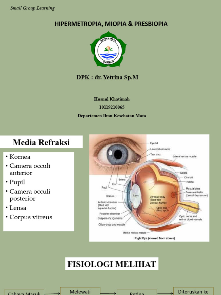 Hipermetrop, Miopia, Presbiopia (Autosaved) | PDF