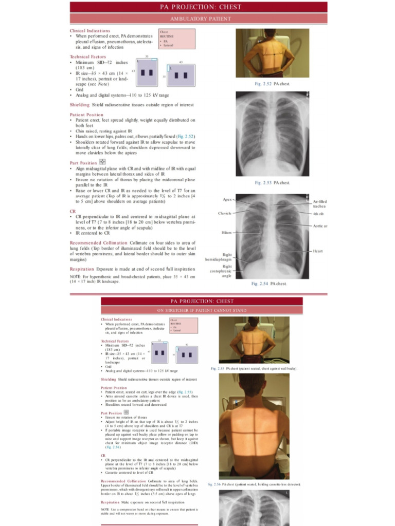 Chest Radiography Positioning | PDF