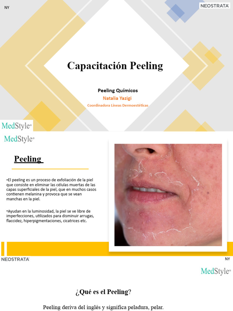 Capacitacion Peeling (Nys) Ok. | PDF | Piel | Medicina CLINICA
