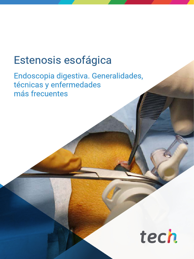 Estenosis Esofágica | PDF | Endoscopia | La enfermedad por reflujo ...