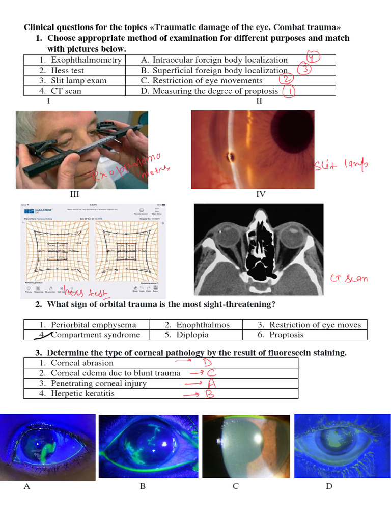 Trauma of Eye | PDF | Injury | Cornea