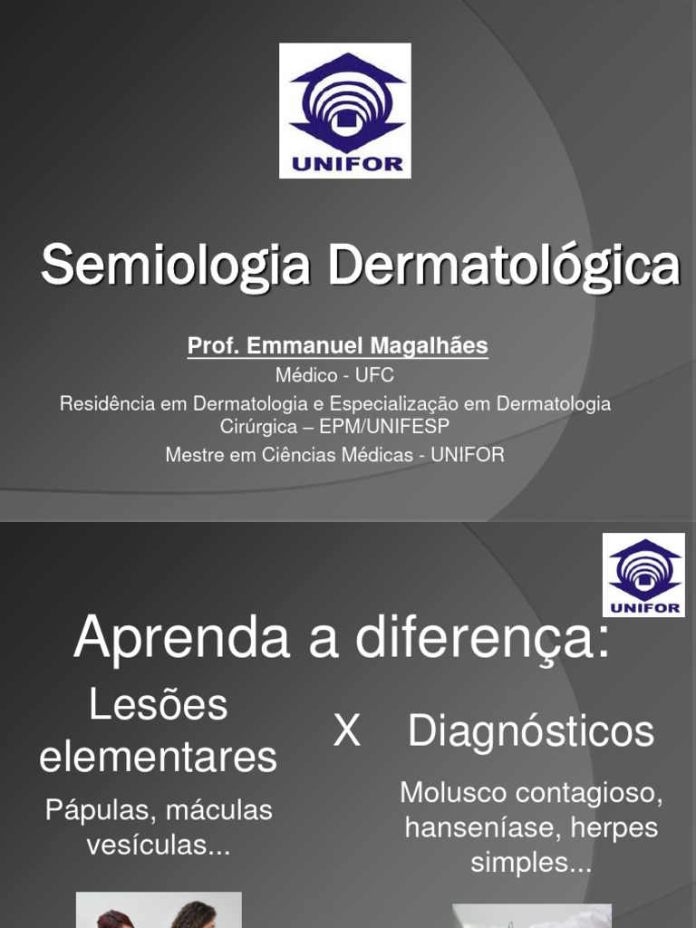 Diferenças entre Lesões Dermatológicas | PDF | Pele | Inflamação