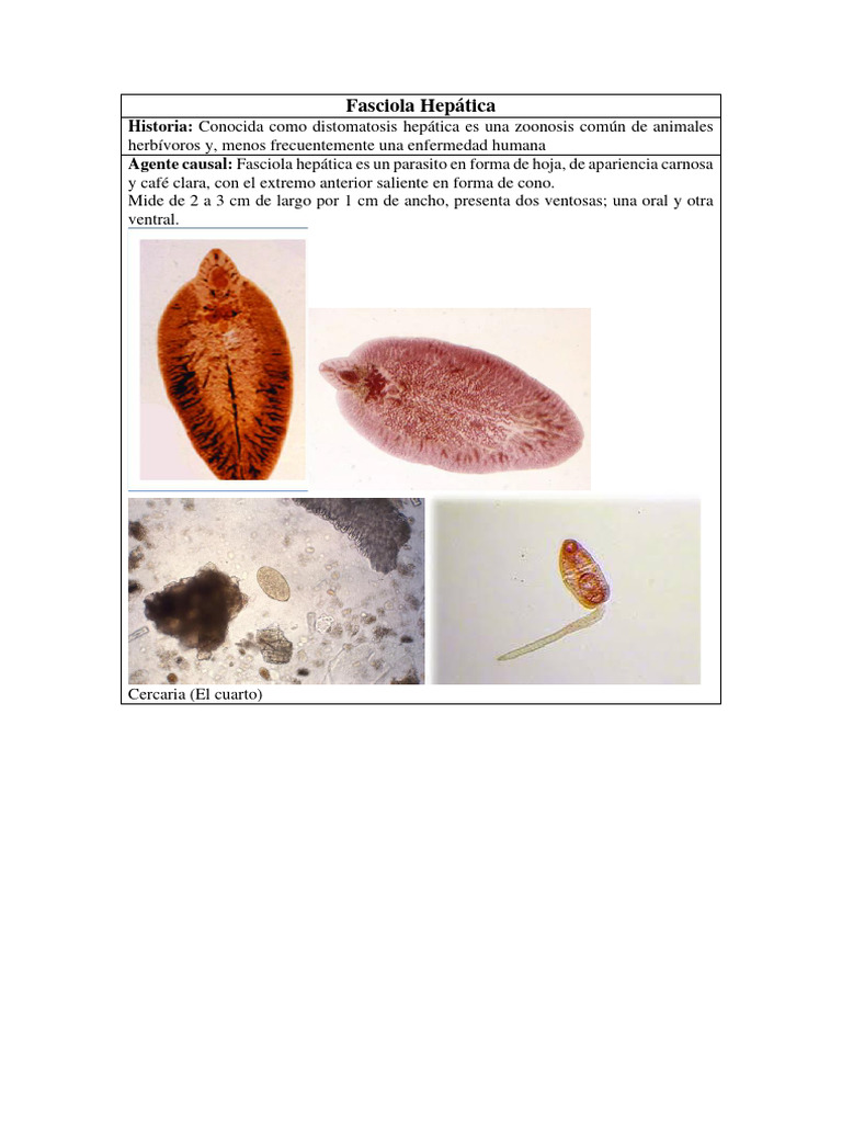 Fasciola Hepática | Descargar gratis PDF | Especialidades Medicas ...