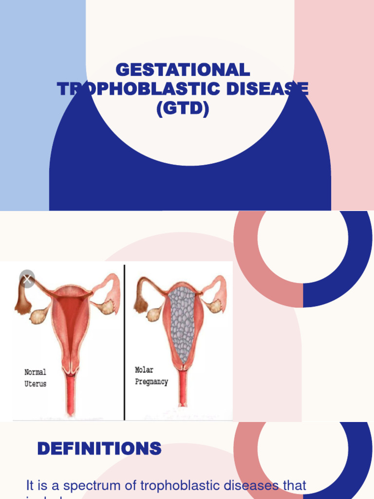 Hydatidiform Mole PDF Type | PDF | Clinical Medicine | Diseases And ...