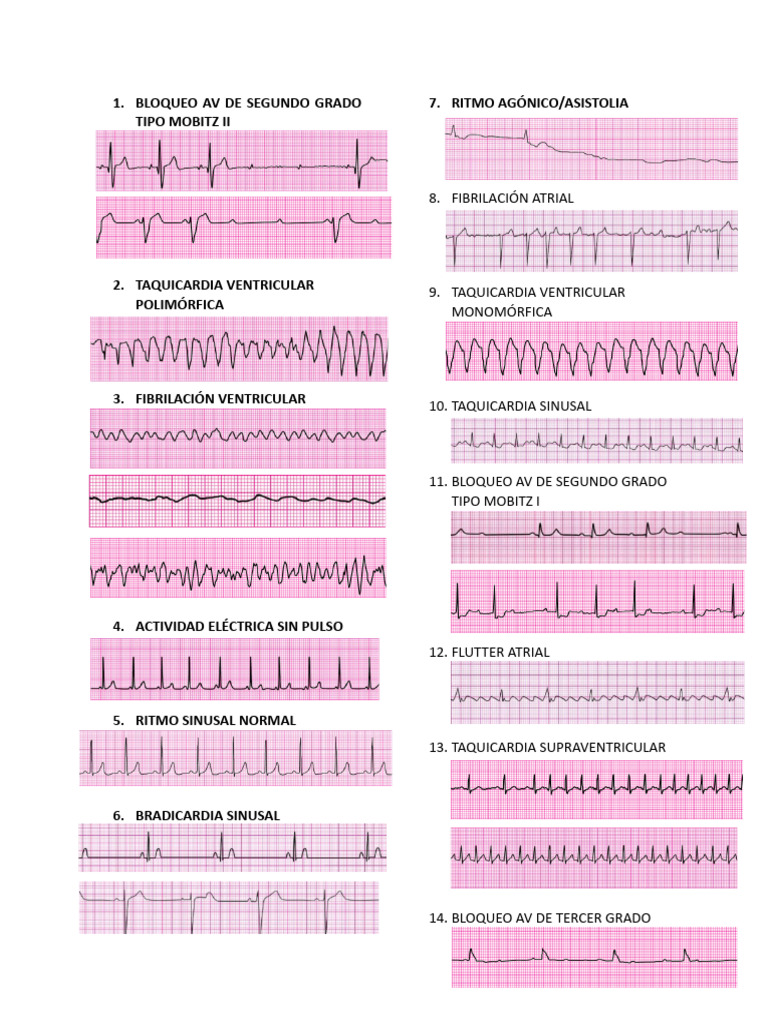 RITMOS ECG ACLS | PDF