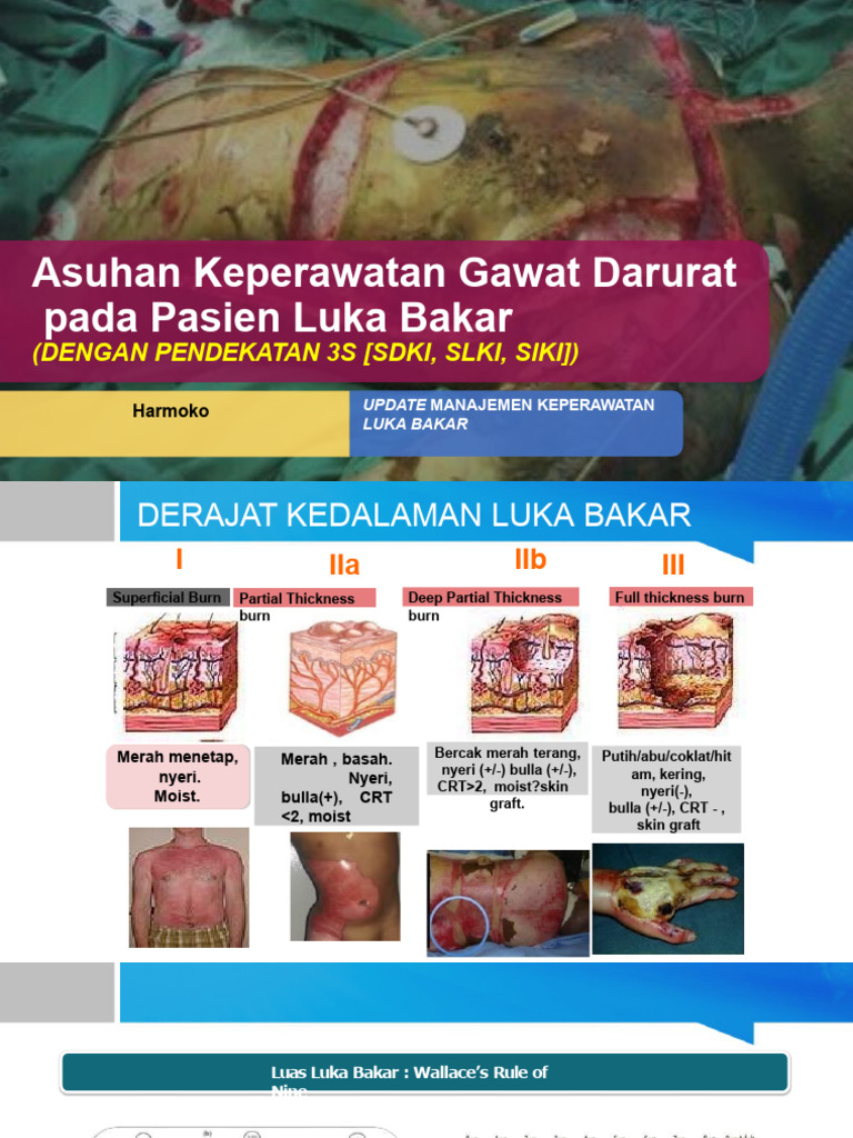 Tugas KGD-Harmoko (Manajemen Luka Bakar, Trauma Kepala, Trauma Muskuloskeletal) | PDF