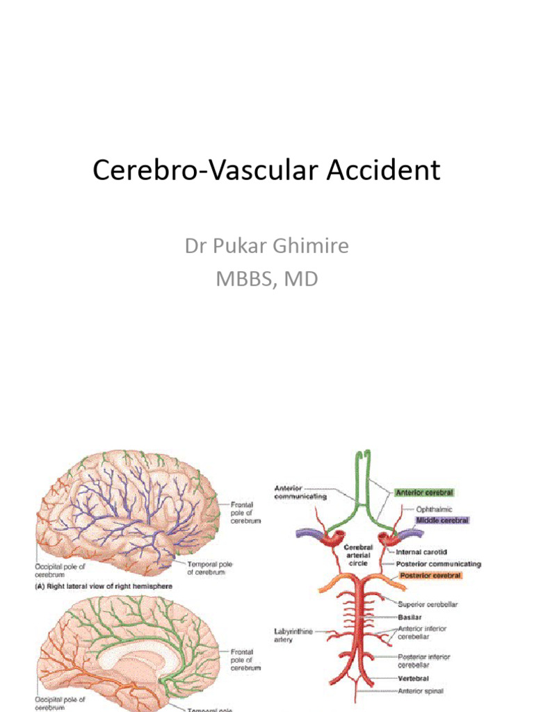 Cerebro-Vascular Accident: DR Pukar Ghimire MBBS, MD | PDF | Stroke ...