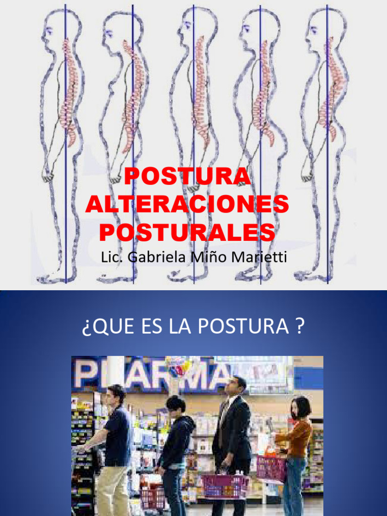 14. CLASE 14. ALTERACIONES POSTURALES | PDF | La columna vertebral ...