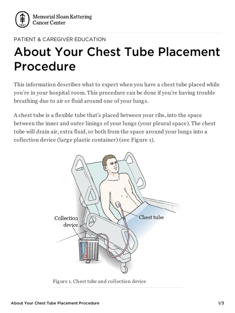 About Your Chest Tube Placement | PDF | Thorax | Lung