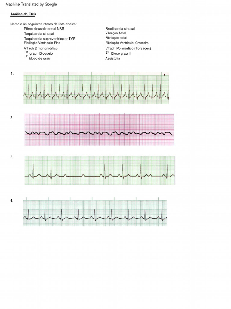 Acls - Análise de Ecg | PDF | Dopamina | Choque (circulatório)
