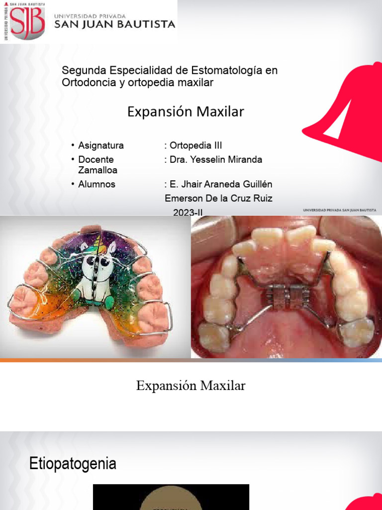 Expansión Maxilar y Diagnóstico | PDF