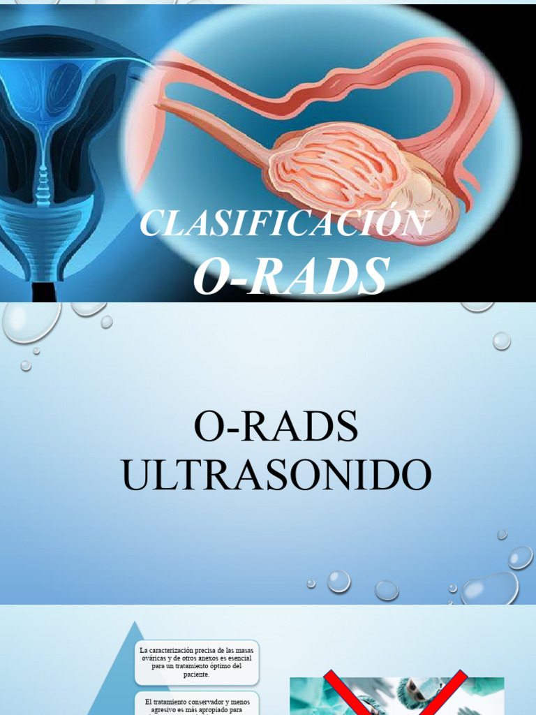Clasificación O RADS | PDF | Cáncer | Ovario