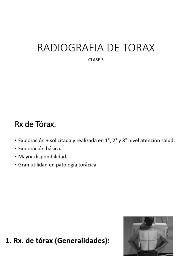 Clase 3 RX de Torax | PDF | Tórax | Pulmón