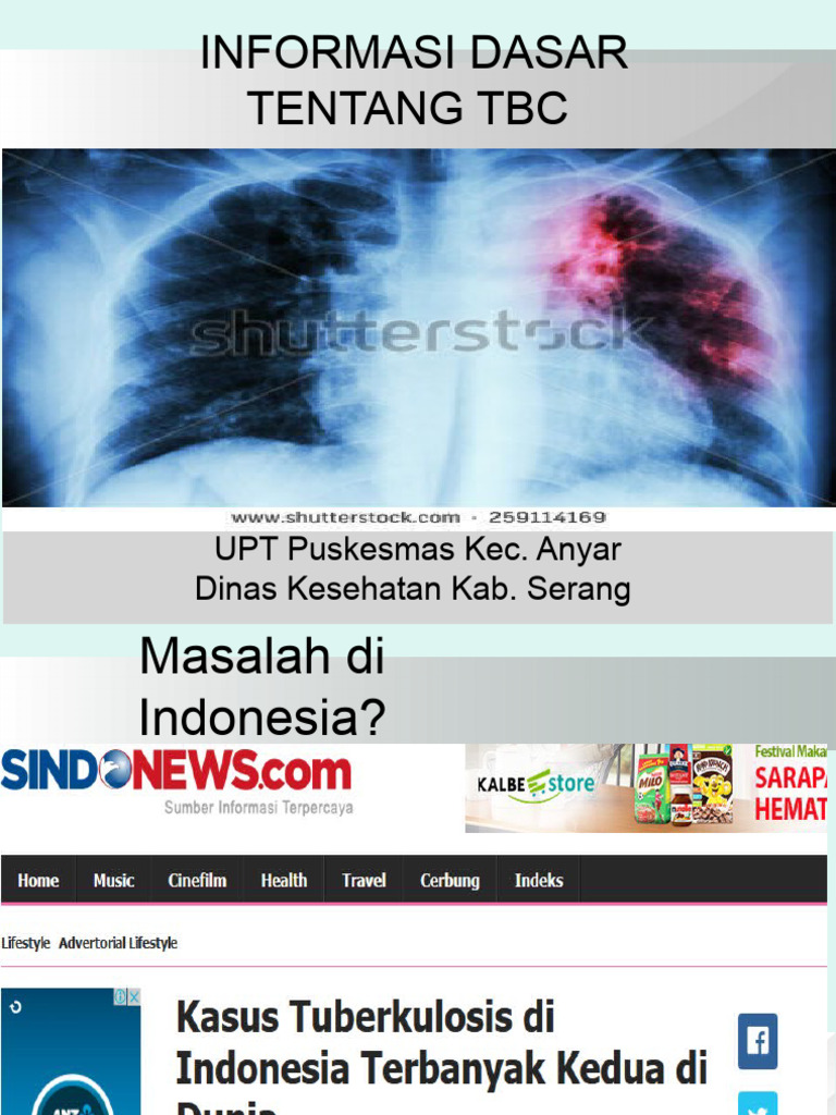 Materi TBC Dasar | PDF