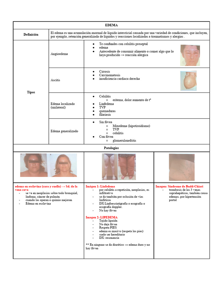 Edema | PDF