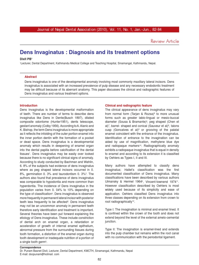 Dens Invaginatus: Diagnosis and Its Treatment Options: Review Article ...