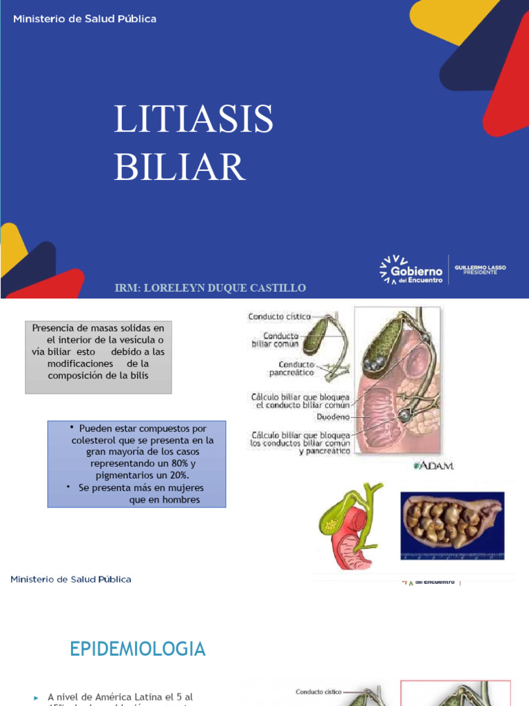 Fisiopatologia De Litiasis Biliar