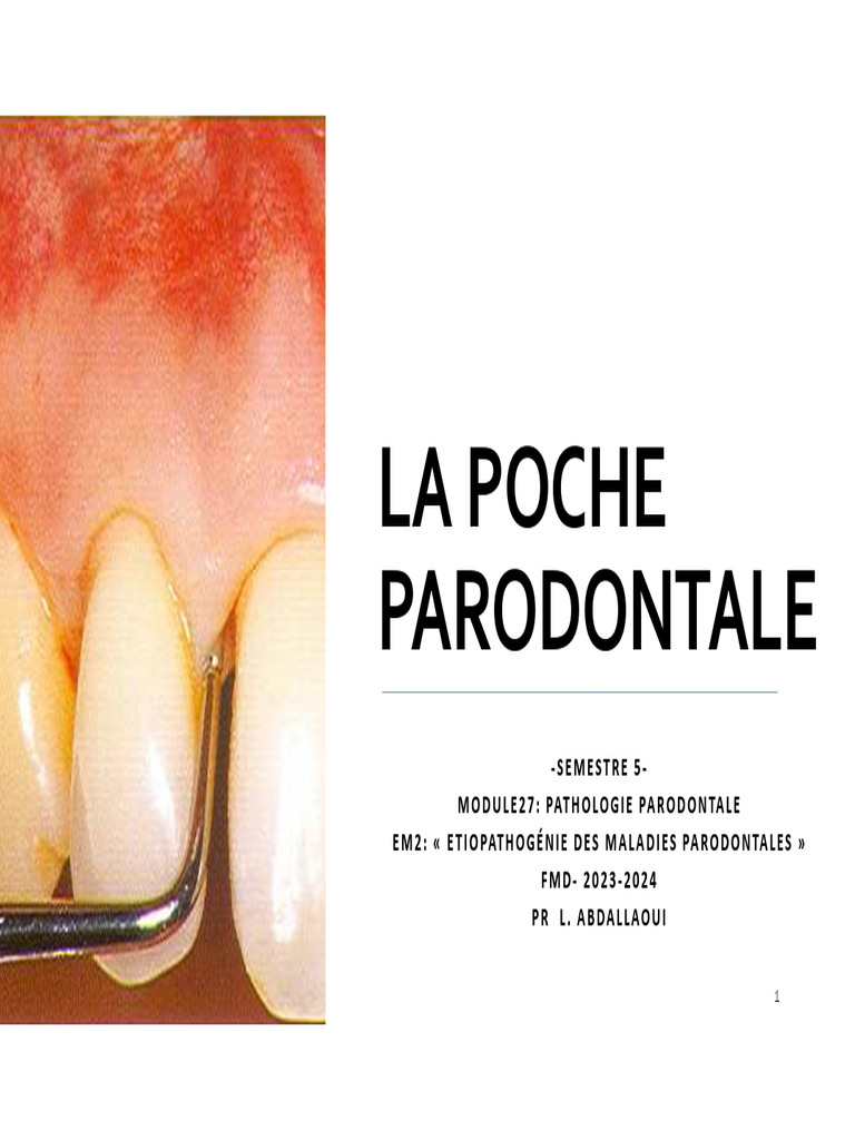 Poche Parodontale : Définition et Traitement | PDF | Épithélium ...