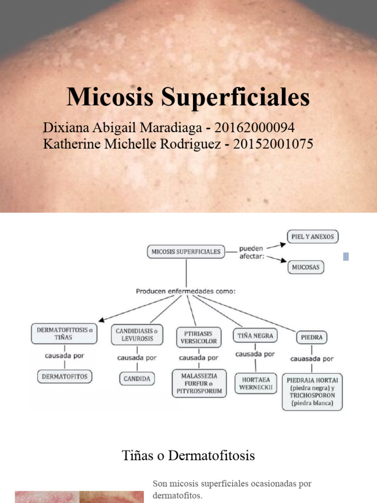 Micosis Superficiales | Descargar gratis PDF | Especialidades Medicas ...