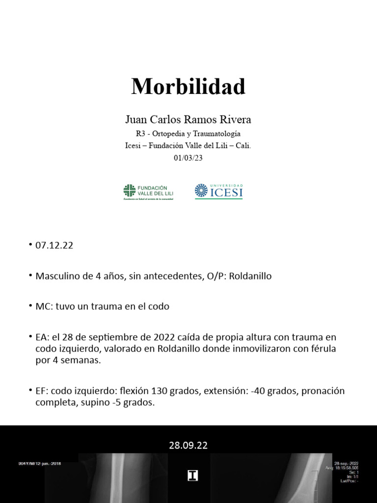 Condilo Lateral Pediatrico | PDF | Codo | Articulaciones