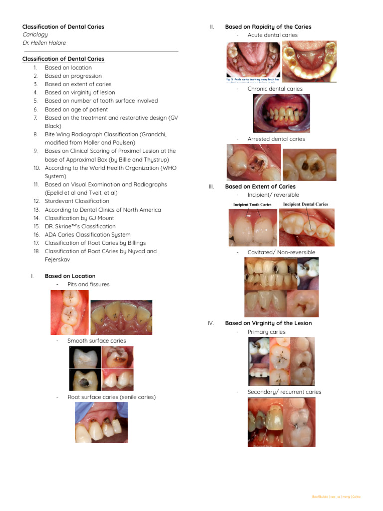 CARIO Classification of Dental Caries | PDF | Tooth Enamel | Tooth