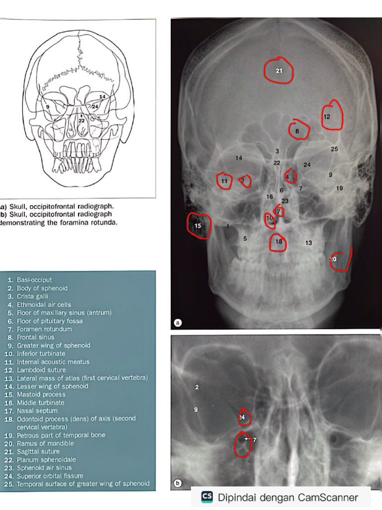 Radiology Anatomy Junior | PDF