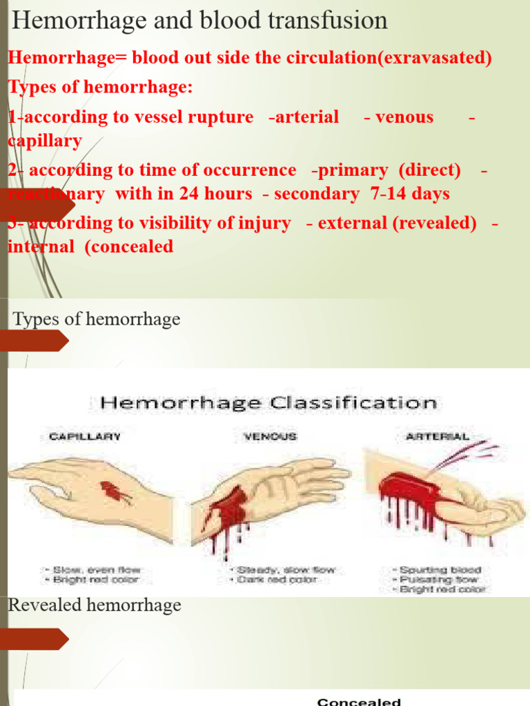 4 - Hemorrhage and Blood Transfusion | PDF | Bleeding | Blood Plasma