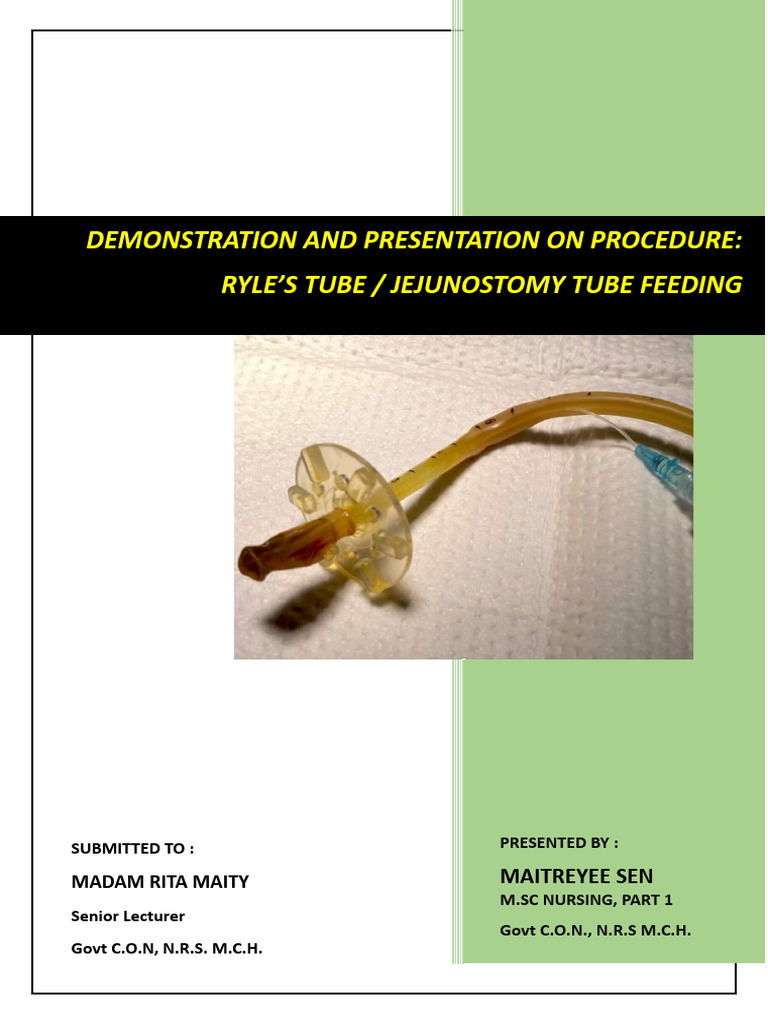 Ryles - Jejunostomy Tube Feeding | PDF | Pancreas | Liver