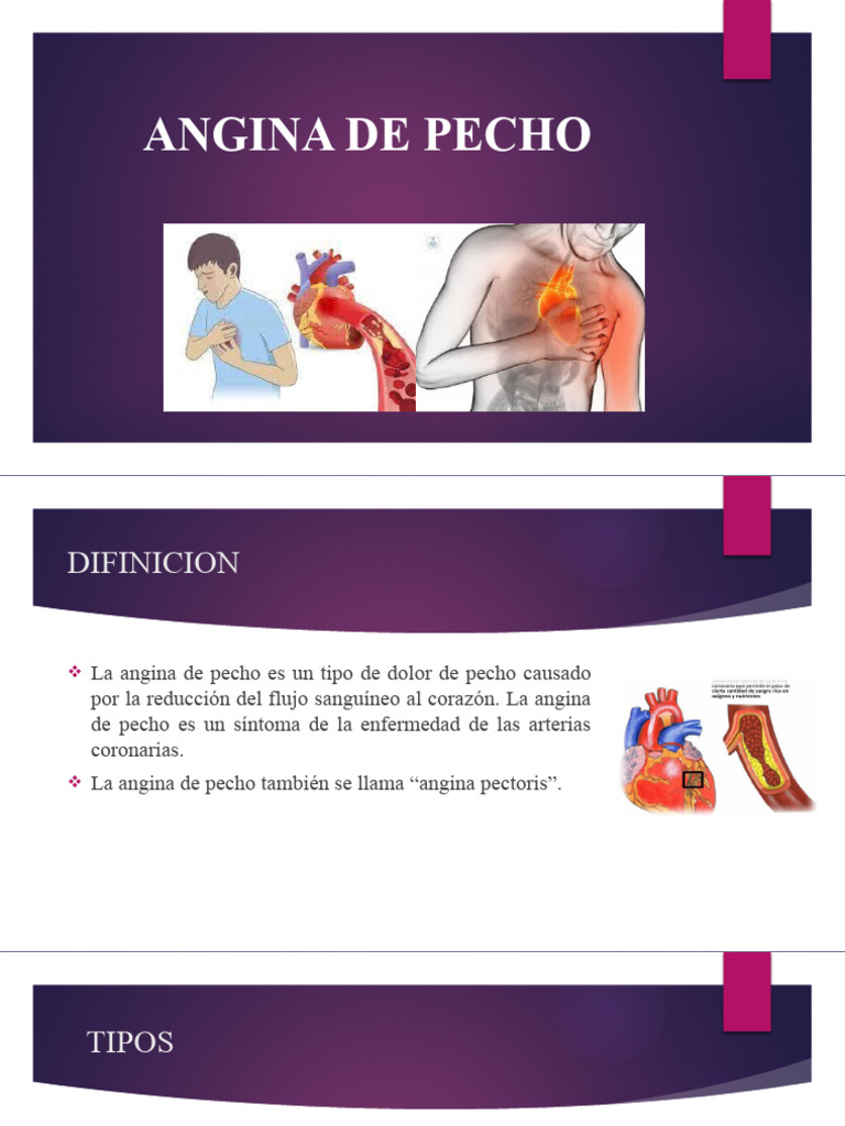 Angina de Pecho: Tipos y Tratamientos | PDF | Enfermedades ...