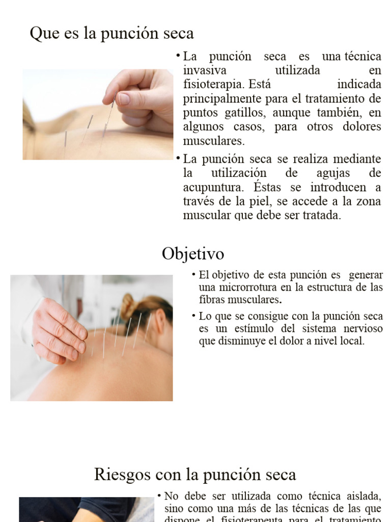 Qué es la punción seca en fisioterapia | PDF