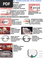 Tipos de Forceps y Elevadores | PDF | Odontología | Boca