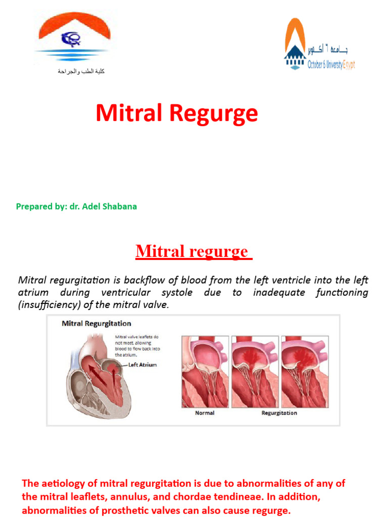 Mitral Regurgitation Overview | PDF | Heart | Heart Failure