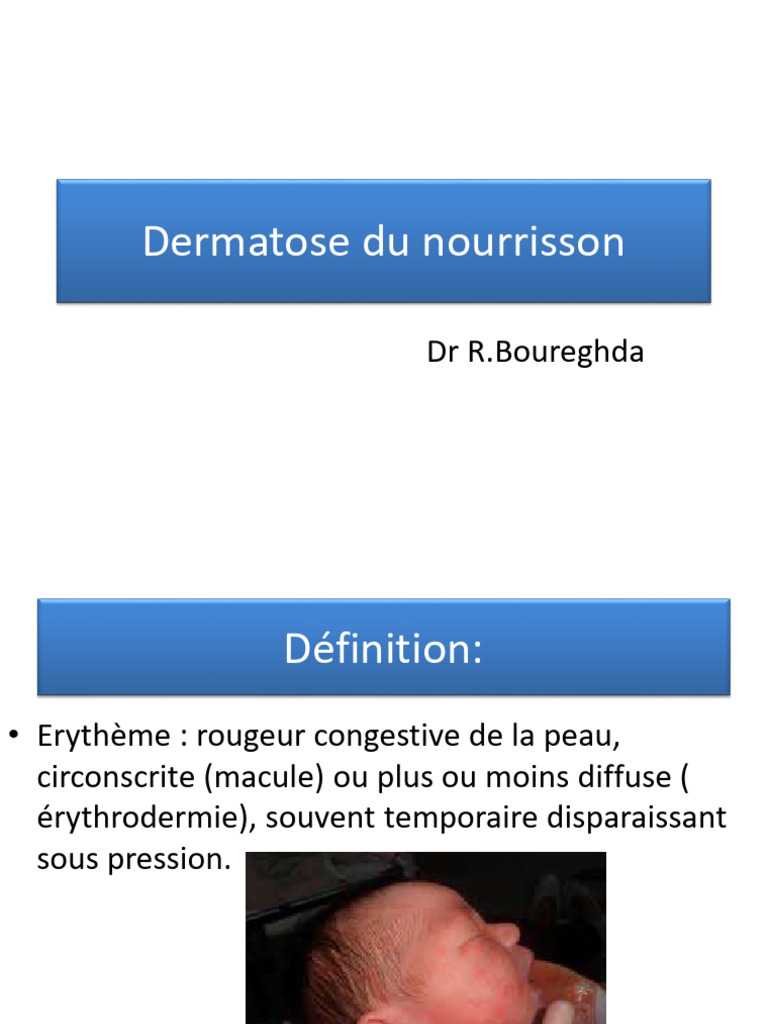 Dermatose Du Nourrisson 1 | PDF | Épidémiologie | Médecine clinique