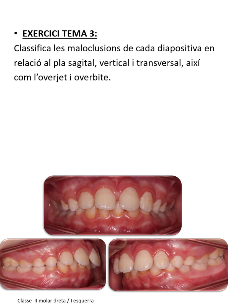 Exercici Maloclusions Tema 3 - Correccions (Per Practicar) | PDF