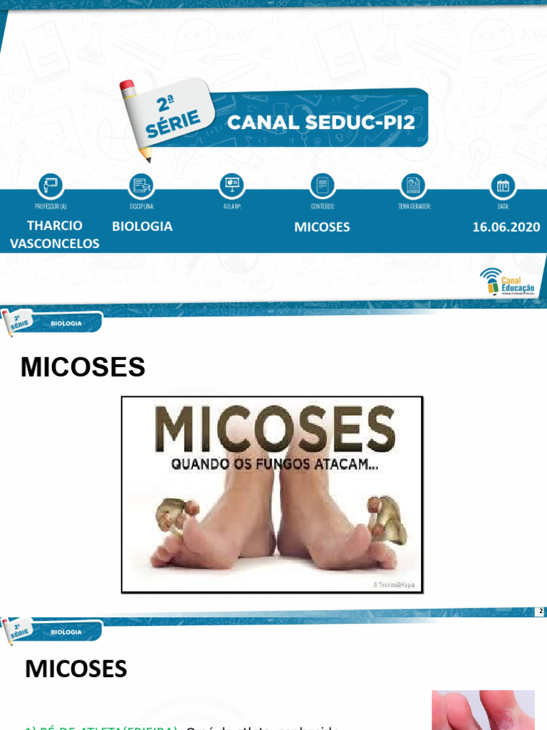 Guia Completo sobre Micoses e Prevenção | PDF
